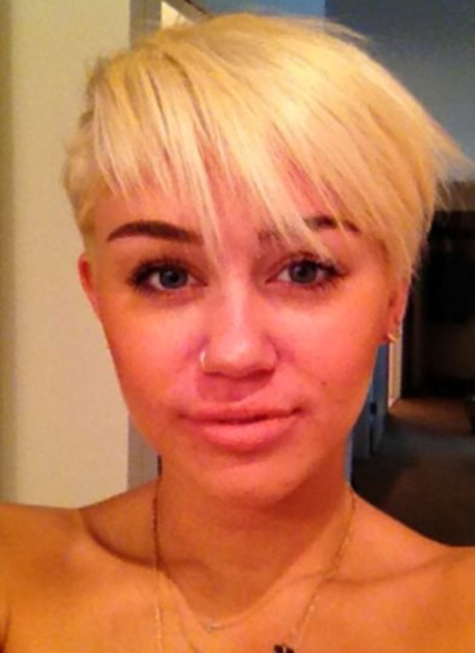 FOTOS: 17 famosas que se atrevieron a mostrar su acné en público ...